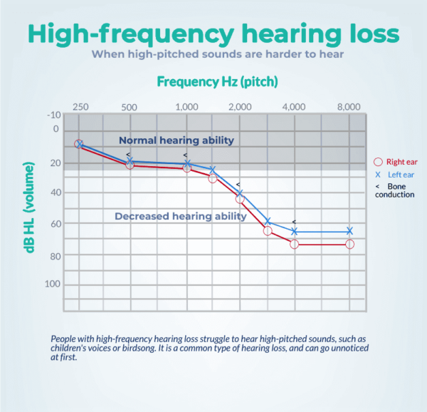 I can hear, just not clearly. Do I have hearing loss? – Houri Hearing ...